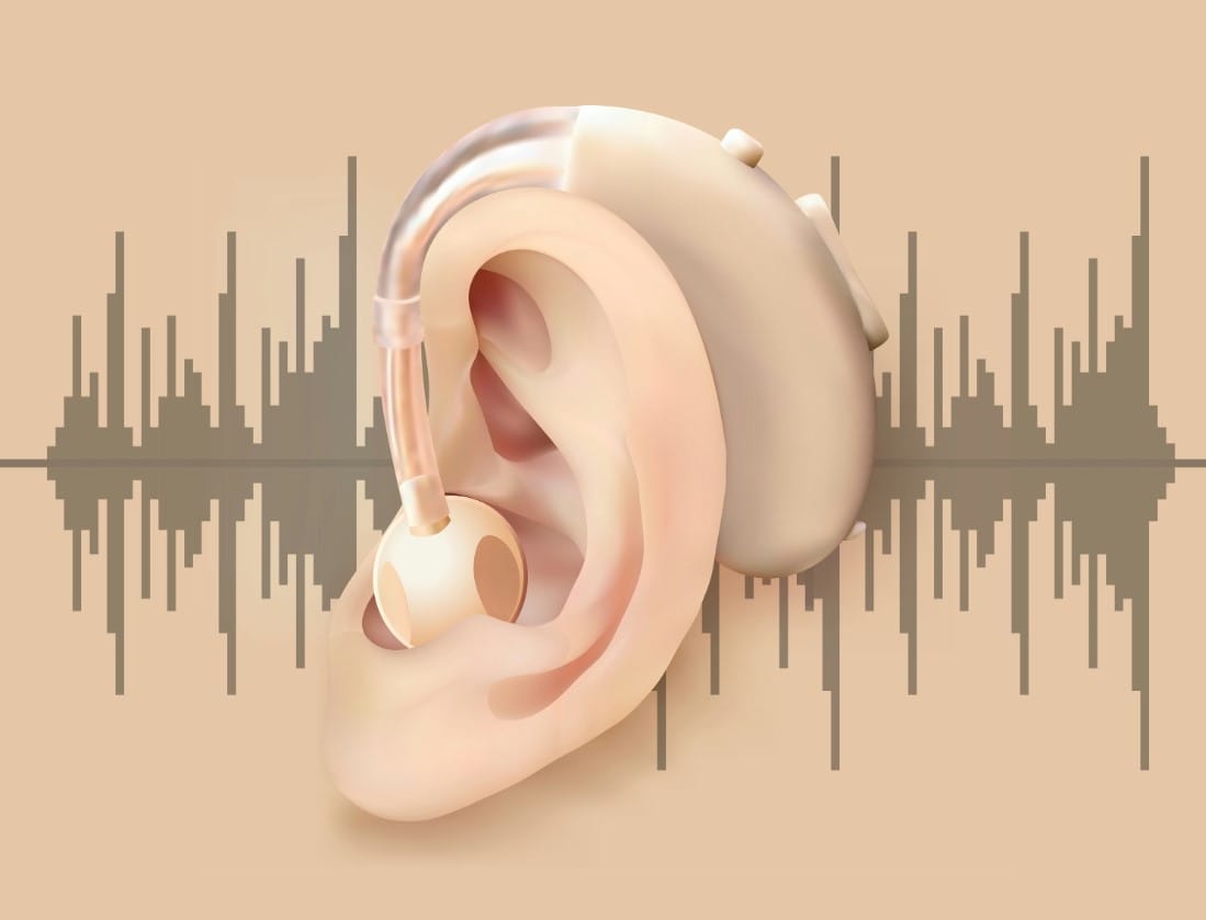 Degrees of Hearing Loss: What Your Hearing Chart (dB) Tells You